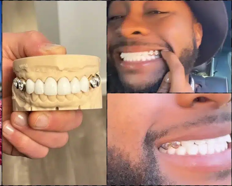 Davido Flaunts New $200k Diamond Encrusted Teeth - Akelicious
